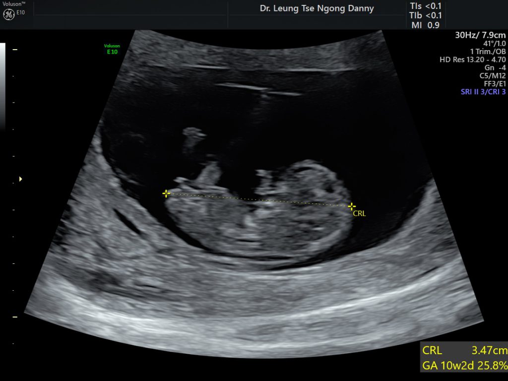 Developmental milestones - HKOG-INFO