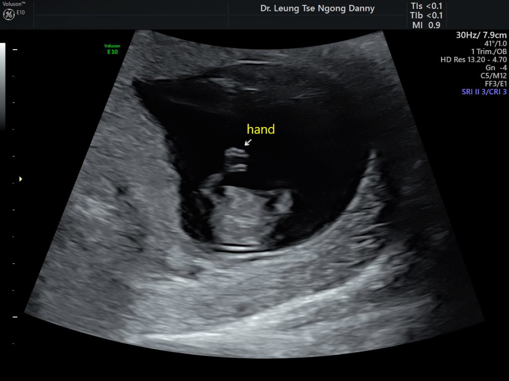 Developmental milestones - HKOG-INFO