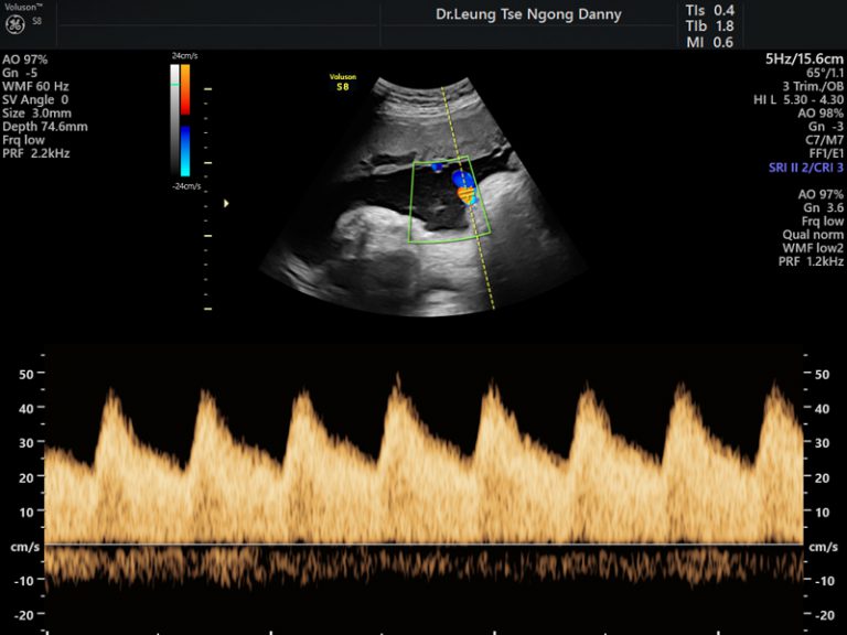 Doppler ultrasound - HKOG-INFO