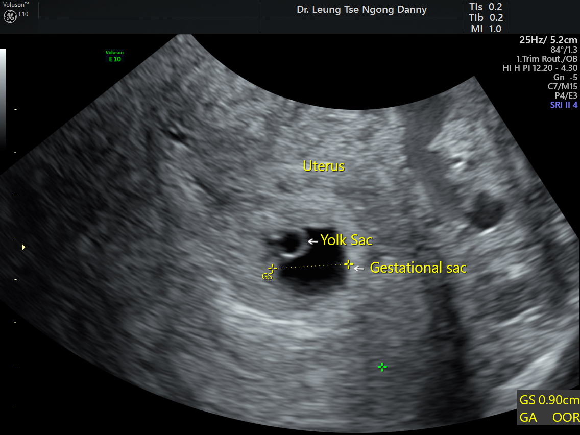 Developmental Milestones HKOG INFO