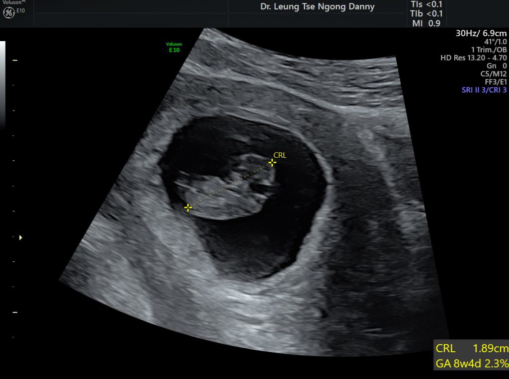 Developmental milestones - HKOG-INFO