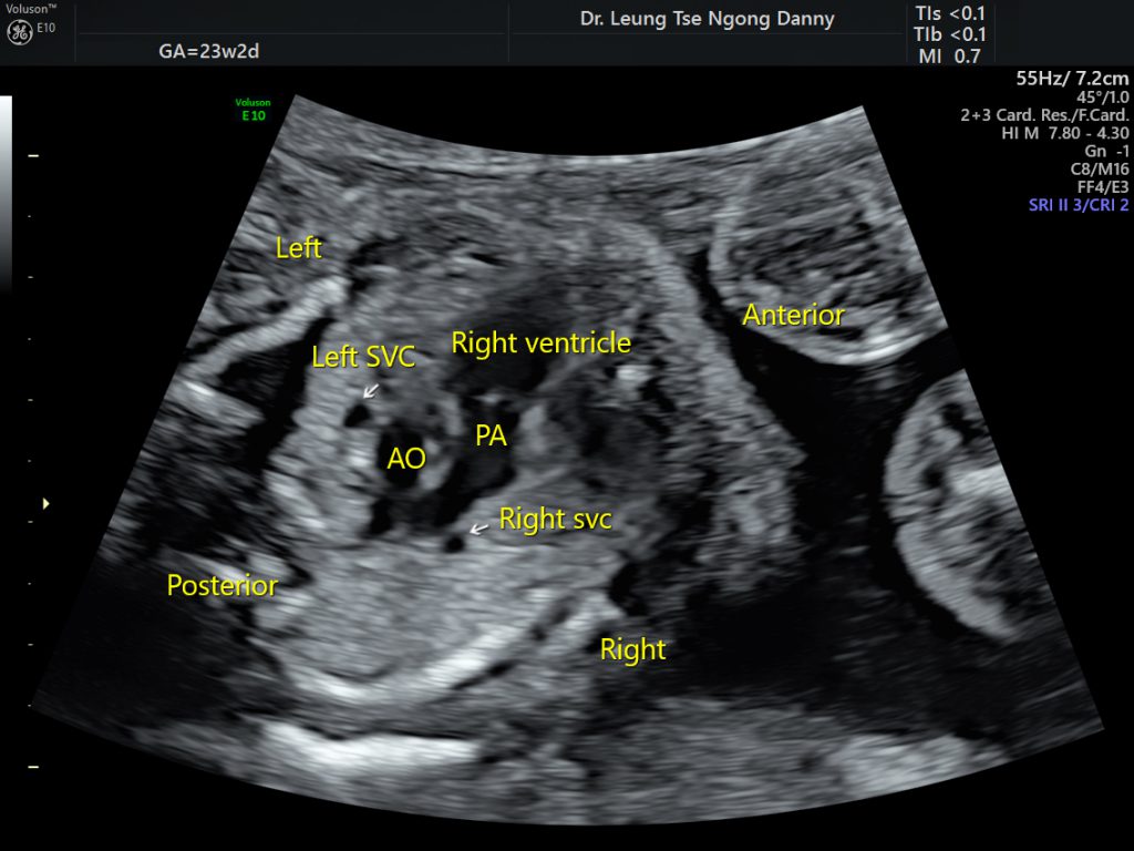 Heart and thorax - HKOG-INFO