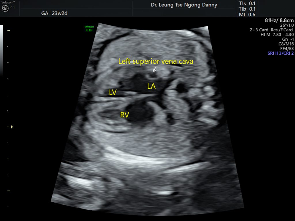 Heart and thorax - HKOG-INFO